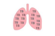 Tuberculosis | Pueblo County
